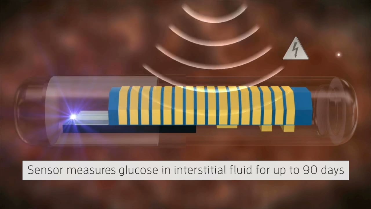 2D Animations - SES001_Eversense on Vimeo