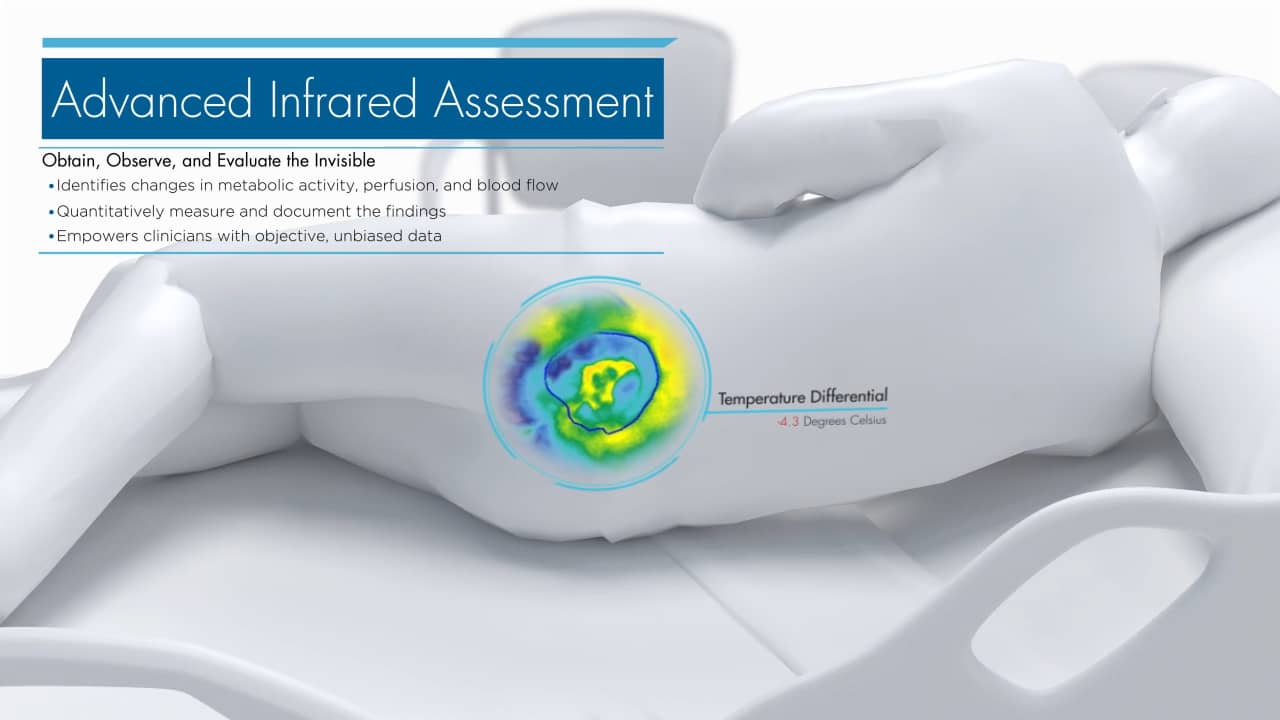 Woundvision - Scout on Vimeo