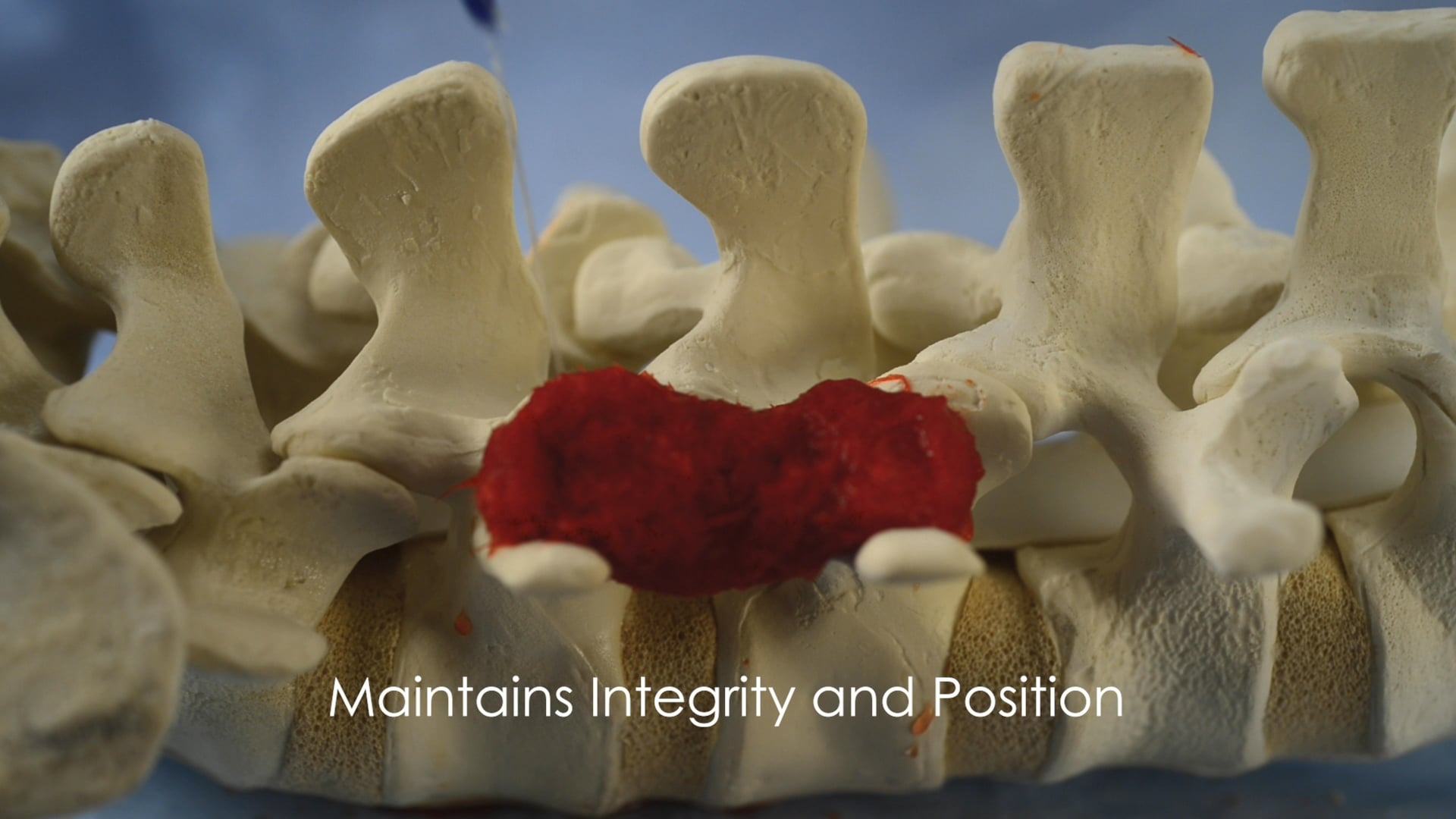 OSTEOAMP SELECT Fibers - Irrigation on Vimeo