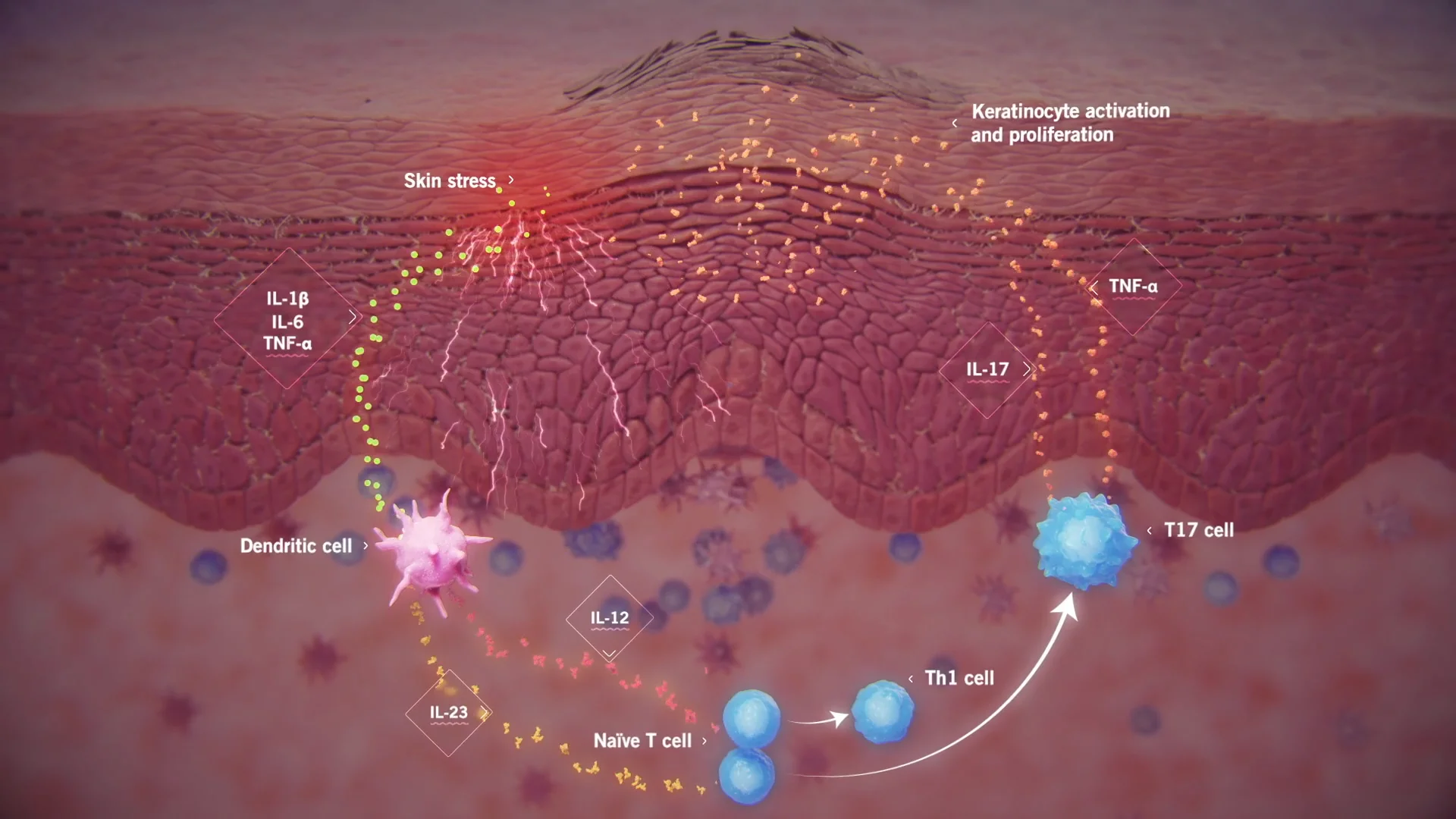 Psoriasis pathway on Vimeo