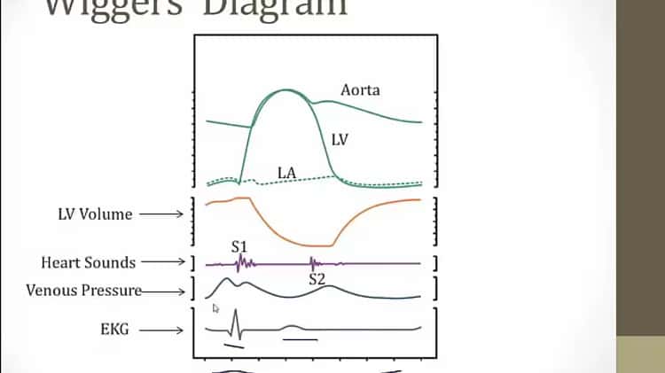 Wiggers Diagram