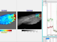 Laser Speckle Contrast Imager - moorFLPI-2 - Moor Instruments