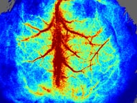Laser Speckle Contrast Imager - moorFLPI-2 - Moor Instruments