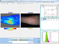 Laser Speckle Contrast Imager - moorFLPI-2 - Moor Instruments