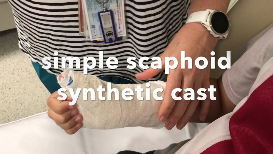 Scaphoid Cast on Vimeo