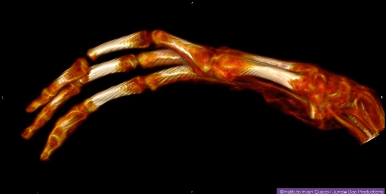 Tridactyl Mummies of Nazca: Maria's Hands on Vimeo