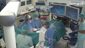 Laparoscopic TEP bilateral inguinal hernia repair: a live interactive ...