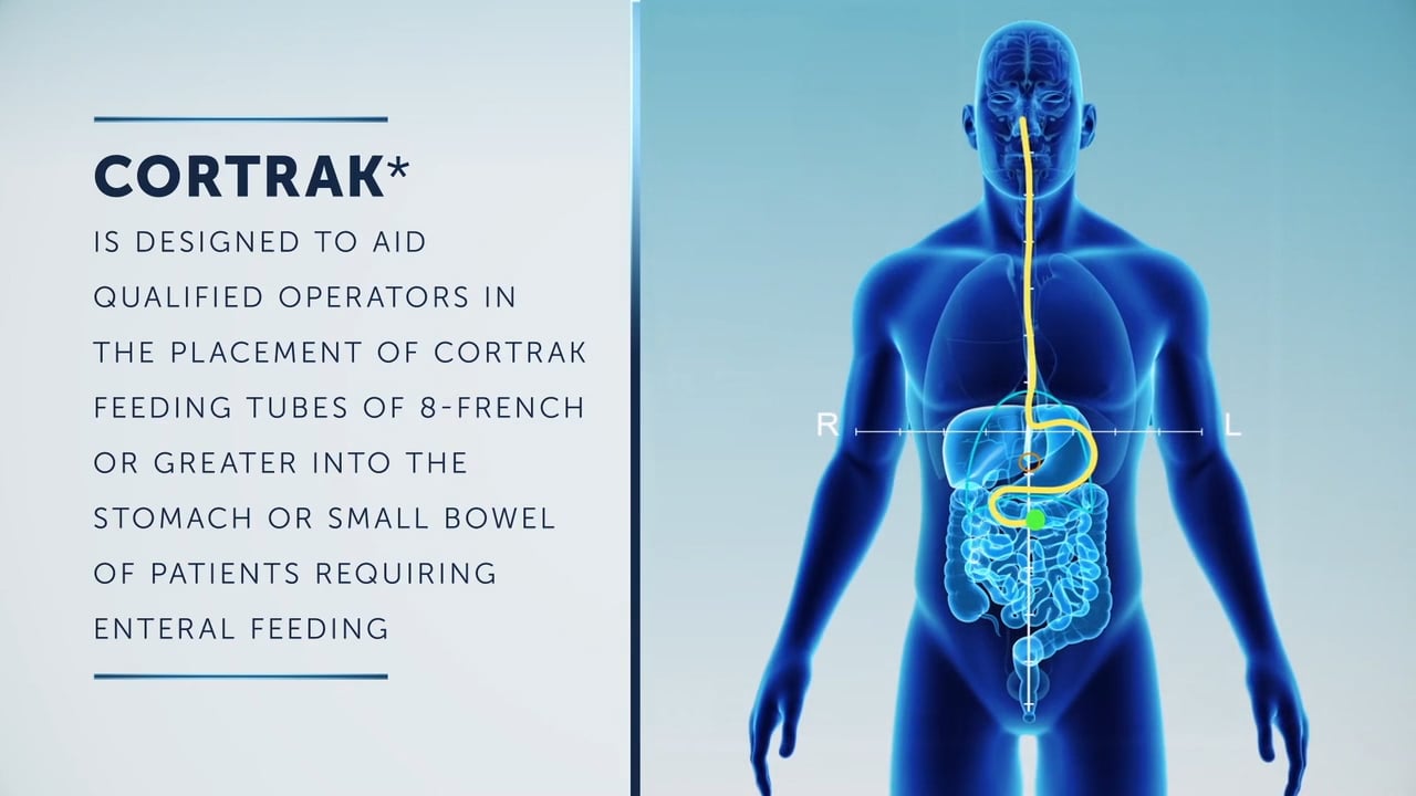 CORTRAK - Instructional Video on Vimeo