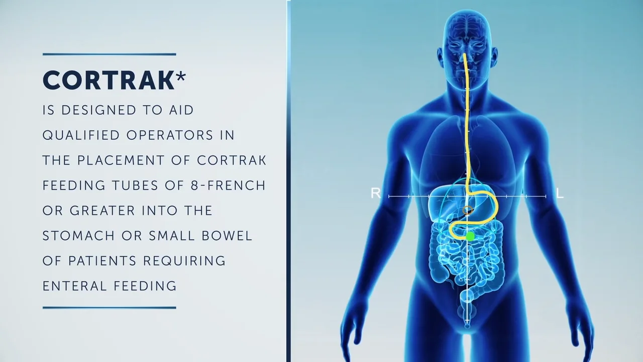 CORTRAK - Instructional Video