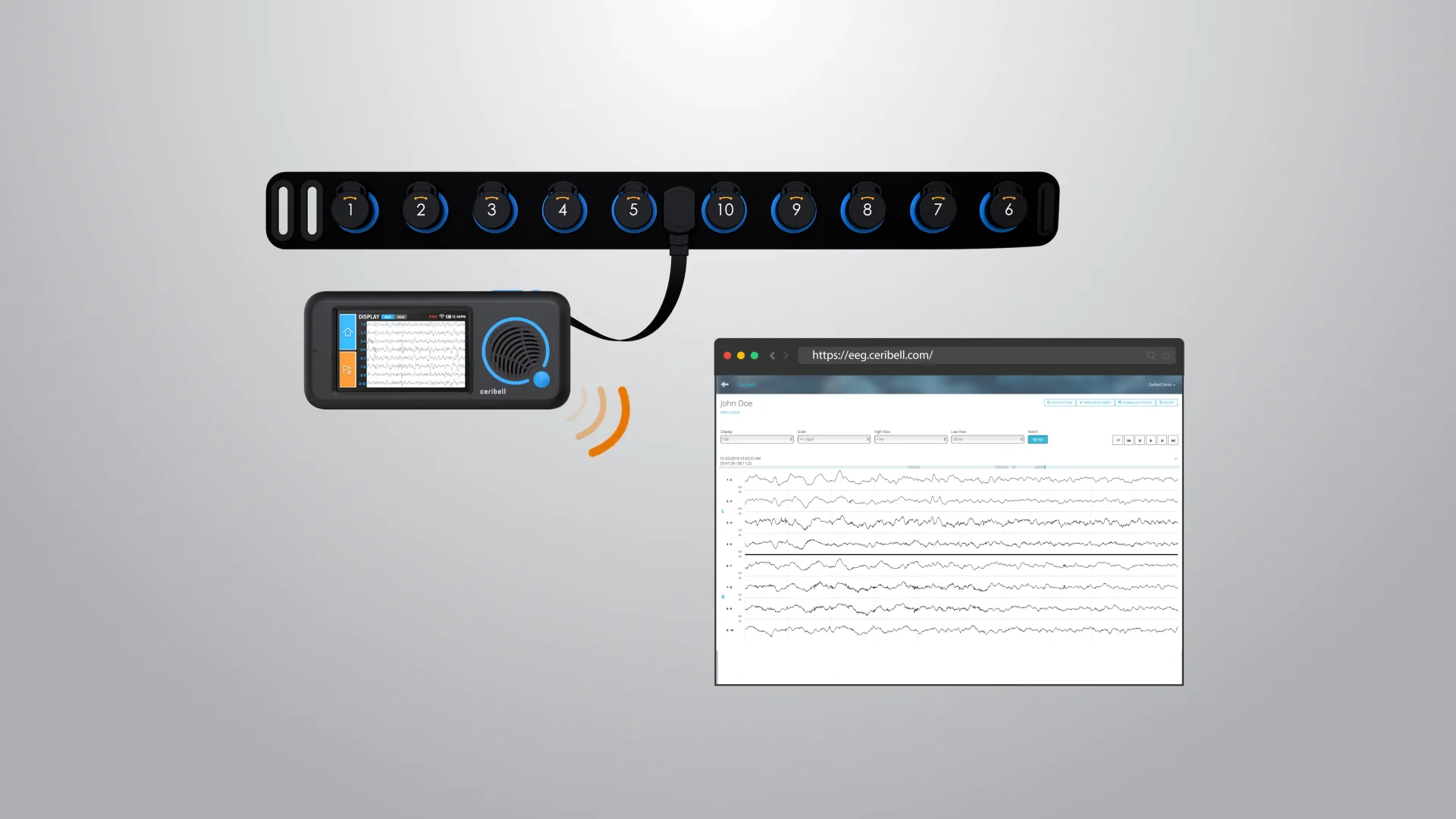Ceribell System Setup with Brain Stethoscope