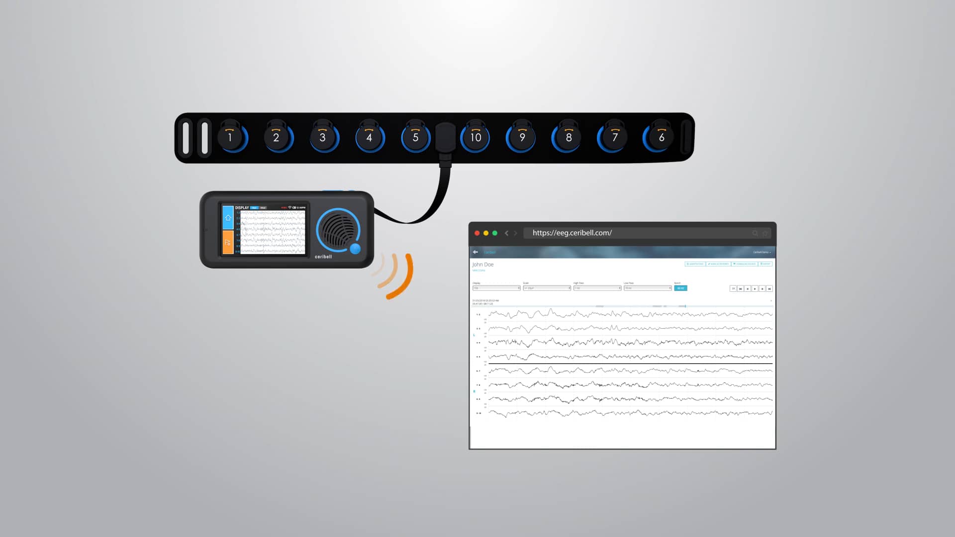 Ceribell System Setup with Brain Stethoscope on Vimeo