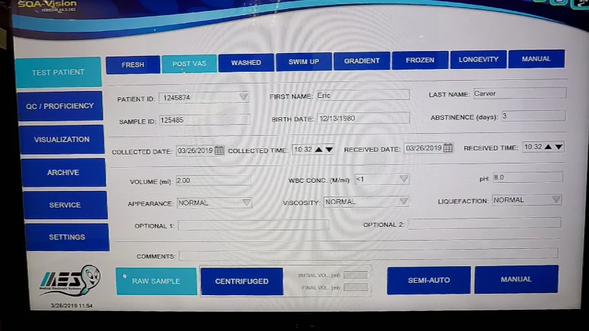 Post Vasectomy Slide Based Visualization Overview and Workflow | SQA ...