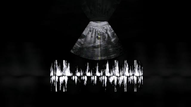 The Birth of Ethan Reece Hambloch on Vimeo