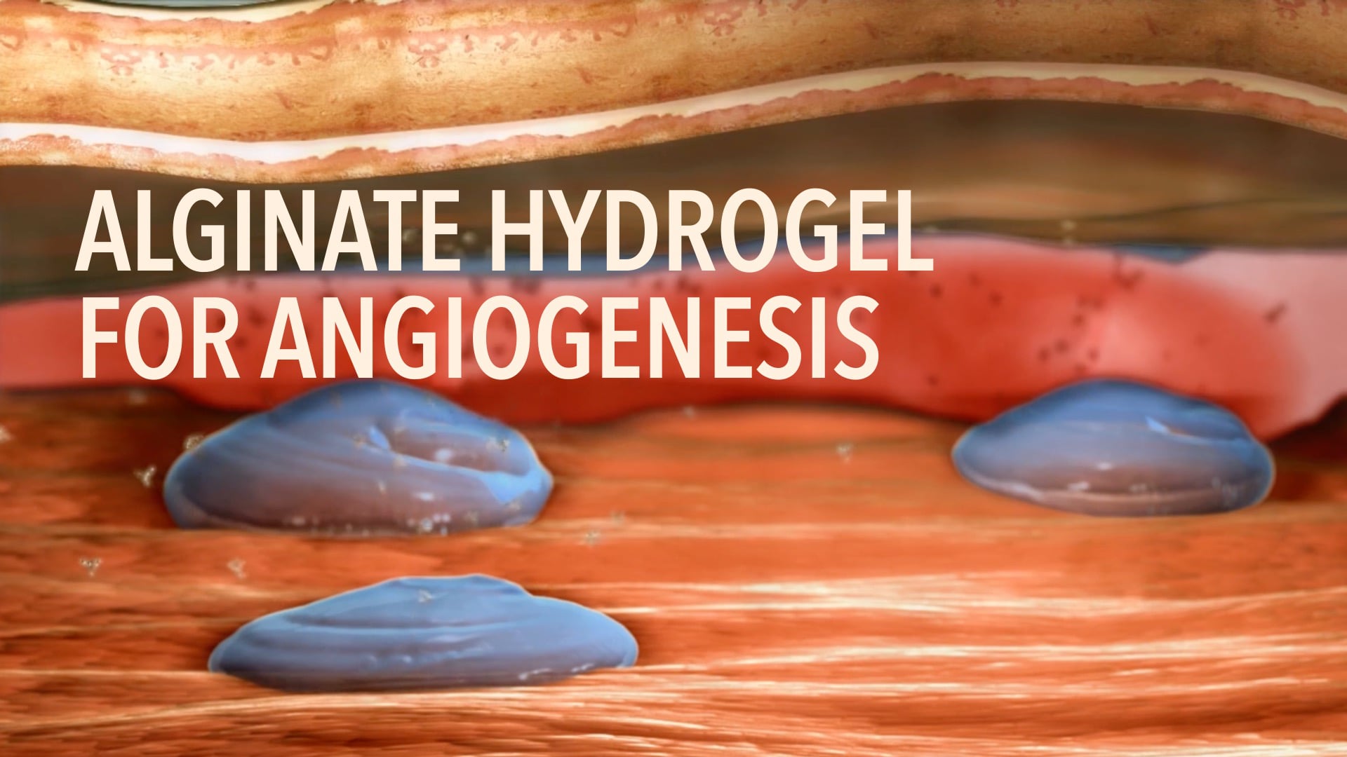 Fresh blood for damaged tissues via alginate hydrogels