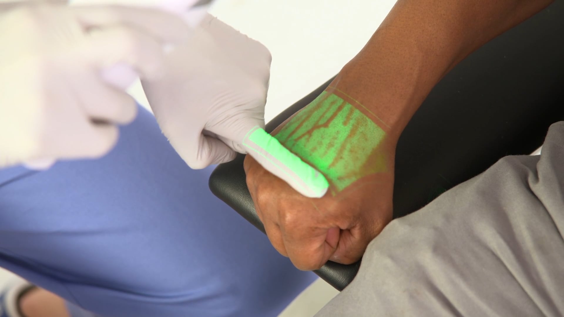 AccuVein AV500 Training