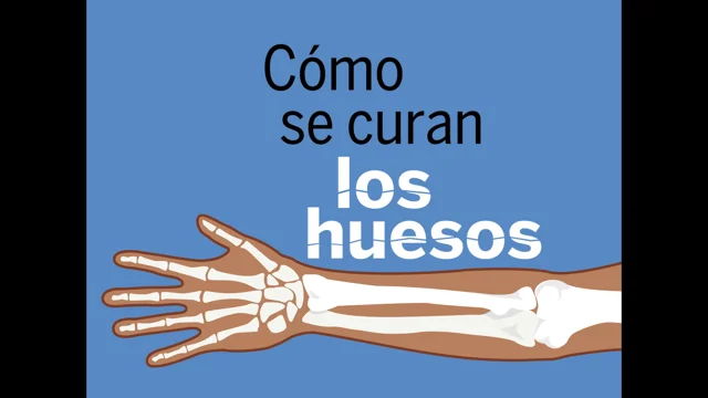 Cuanto Demora En Sanar Una Fisura De Hueso Hot Sale | siliconpower.com Cuanto Demora En Sanar Una Fisura De Hueso Hot Sale | siliconpower.com