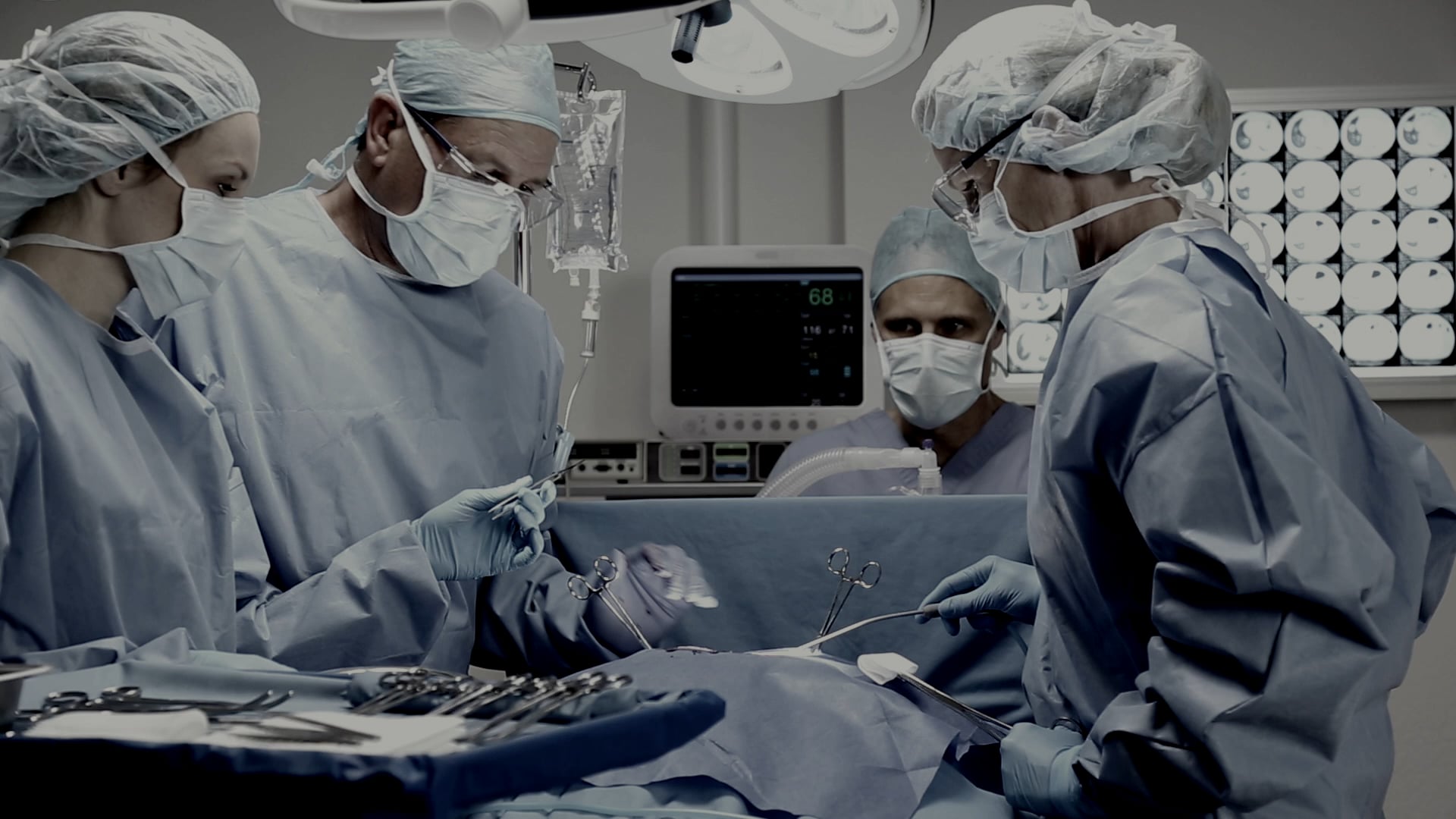 Chapter One: Use of Mesh Bladder Sling for Stress Urinary Incontinence ...