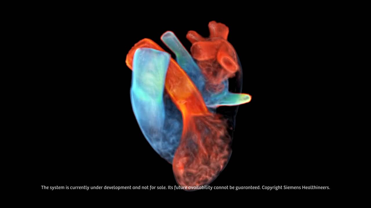 Siemens Healthineers - Digital Twin of the Heart on Vimeo
