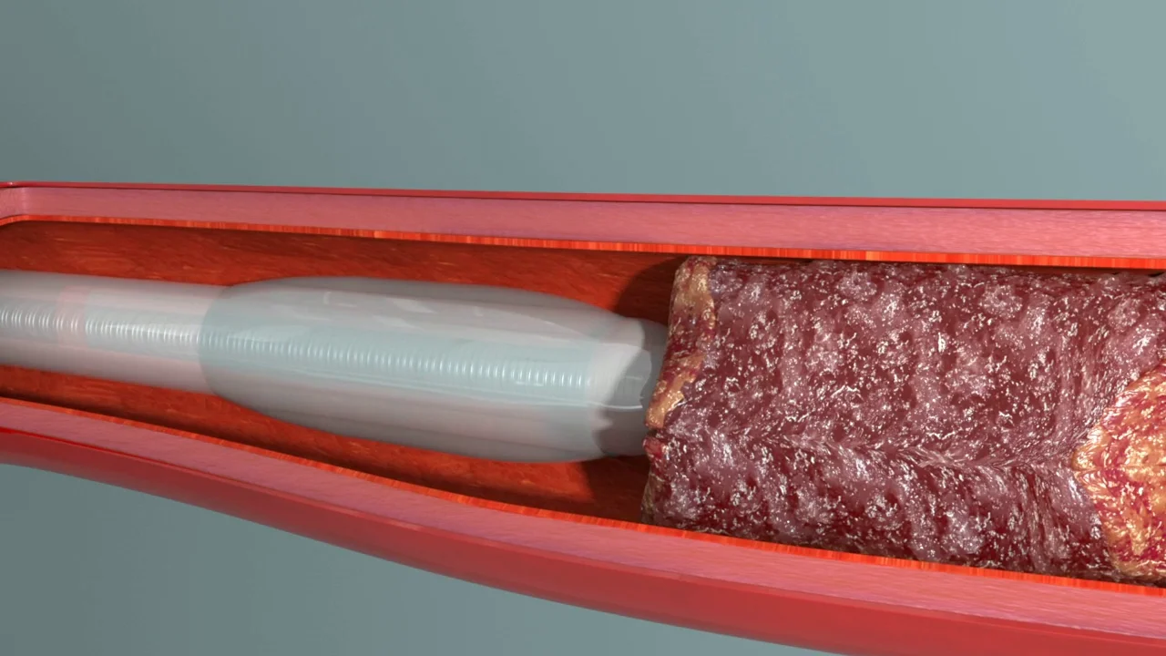 CapBuster Animation on Vimeo