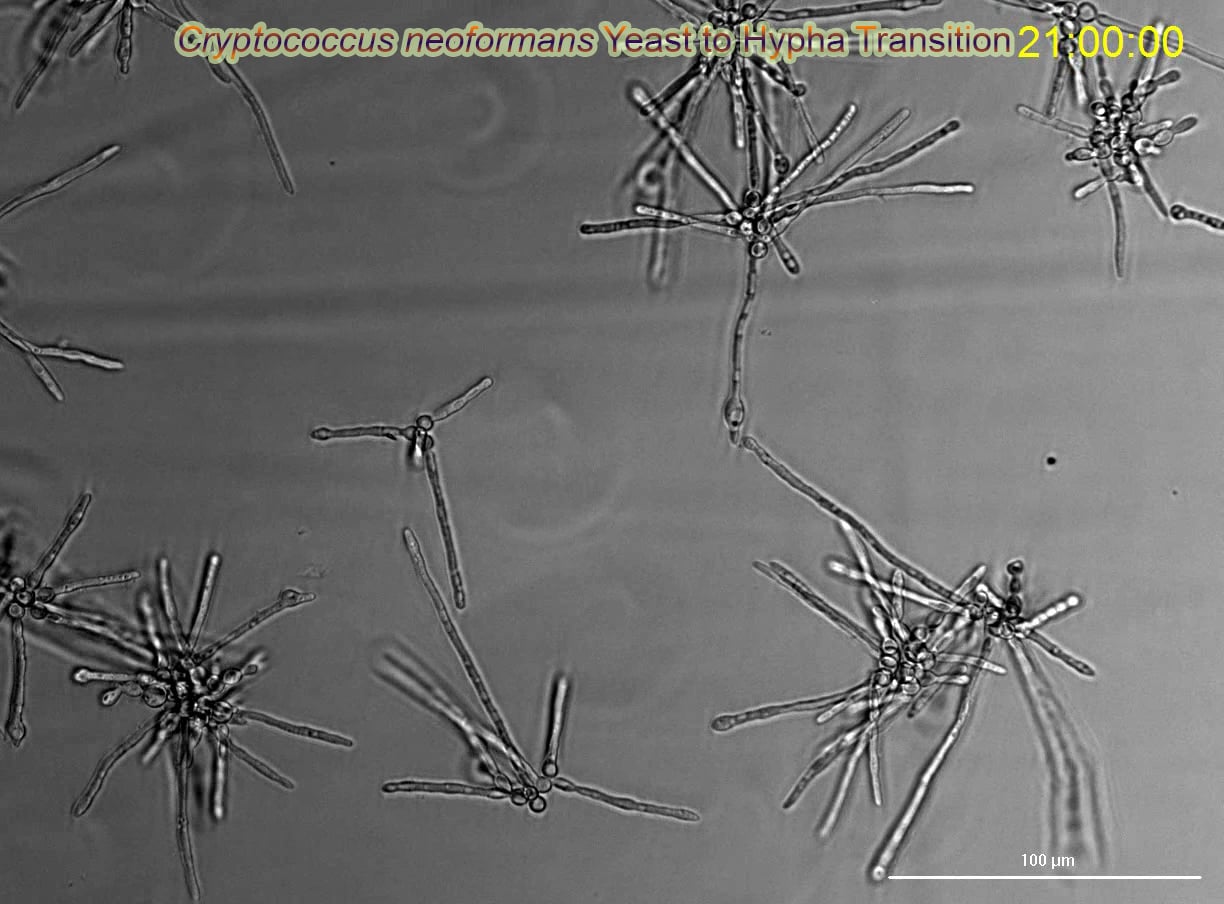 Life Cycle of Cryptococcus neoformans: Supplemental Video 1 on Vimeo