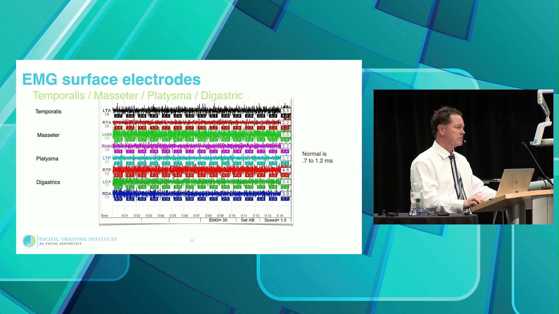 EMG Guided Therapeutic Botulinum Toxin Therapy on Vimeo
