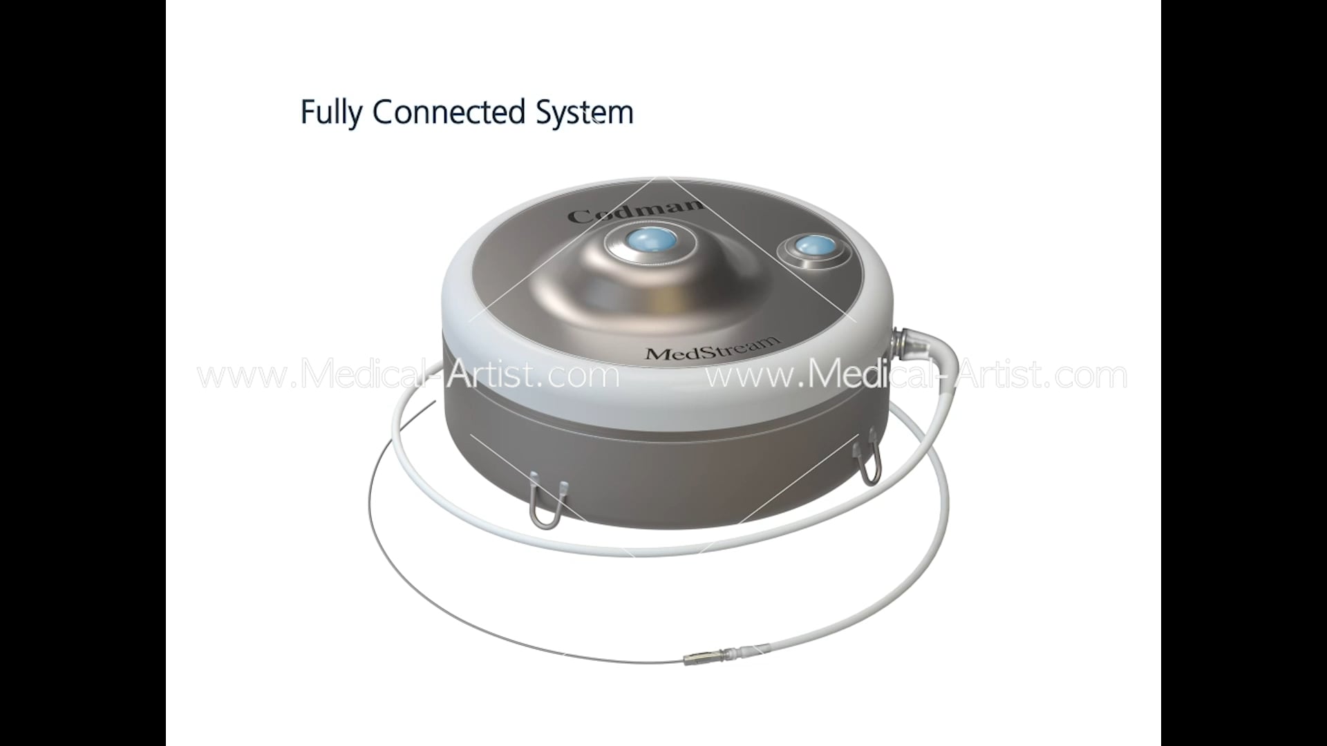 Drug Delivery System Catheter Connection Guide Animation for Codman ...