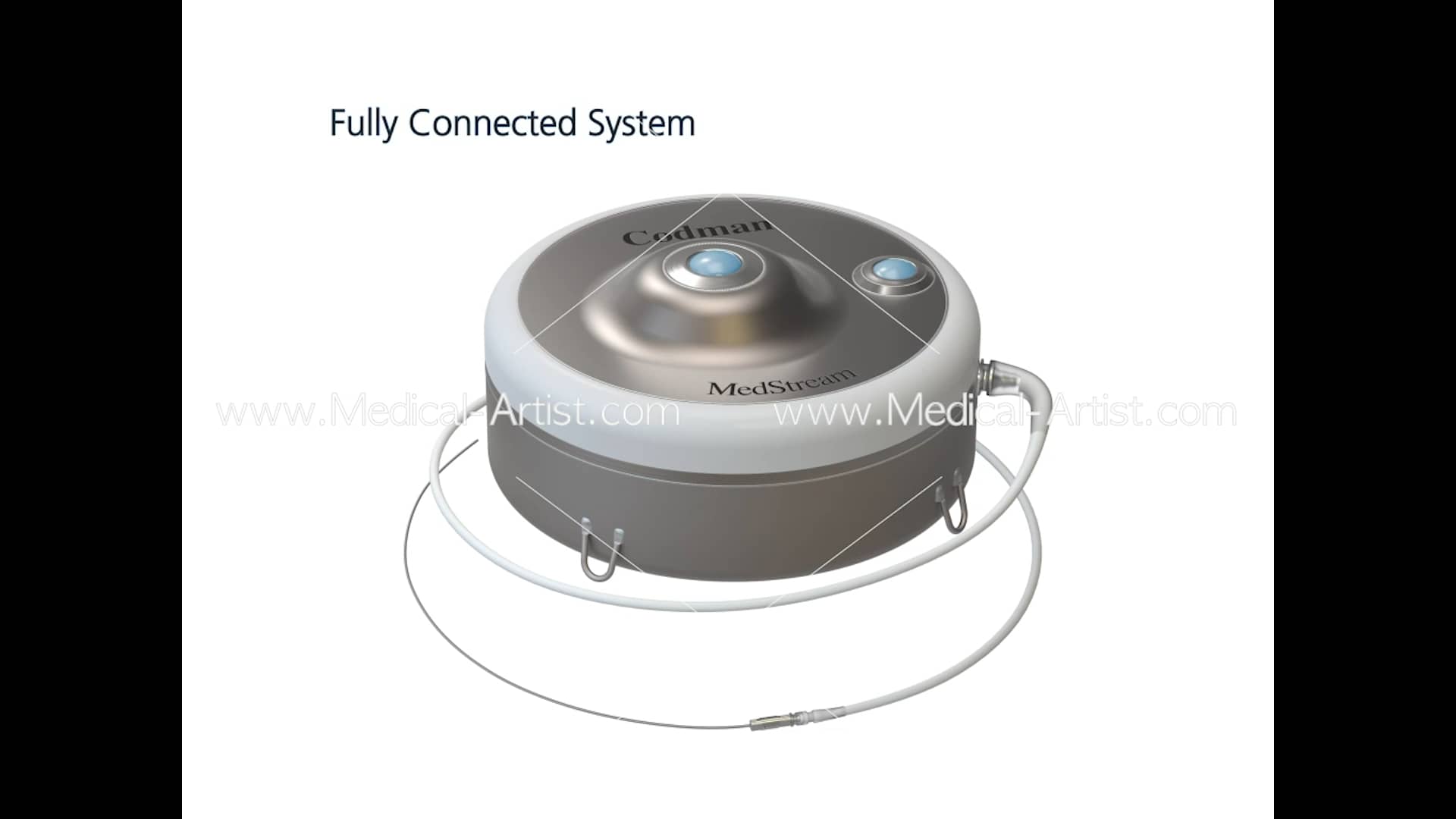 Drug Delivery System Catheter Connection Guide Animation for Codman ...