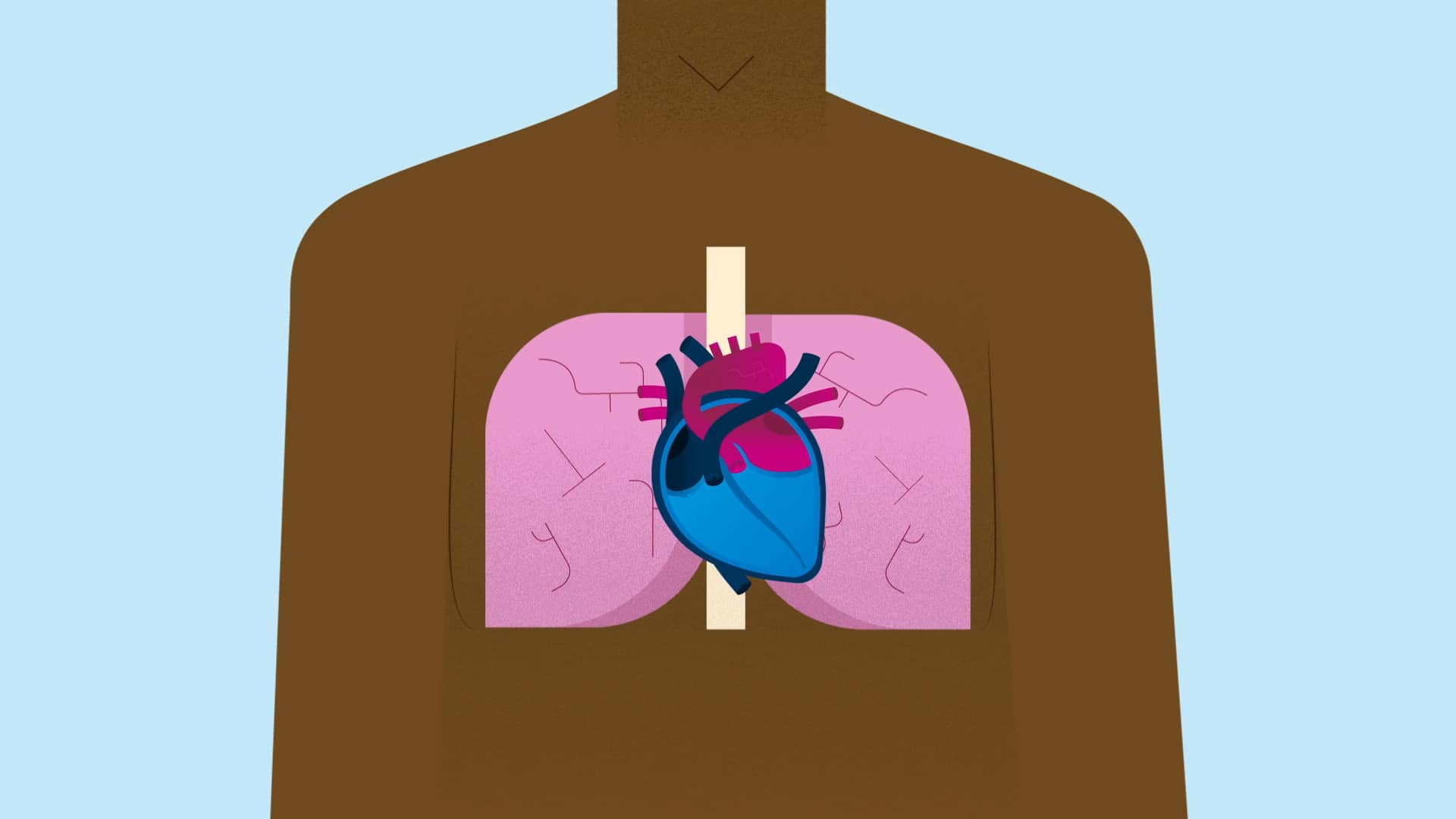Bupa Health - Heart Surgery Animation on Vimeo