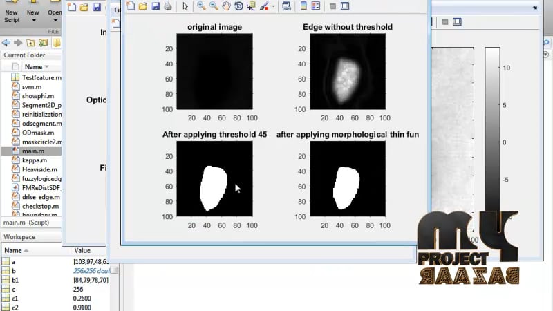 Glaucoma Detection from Fundus Images Using MATLAB GUI - MyProjectBazaar on Vimeo