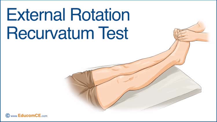 External Rotation Of Ankle