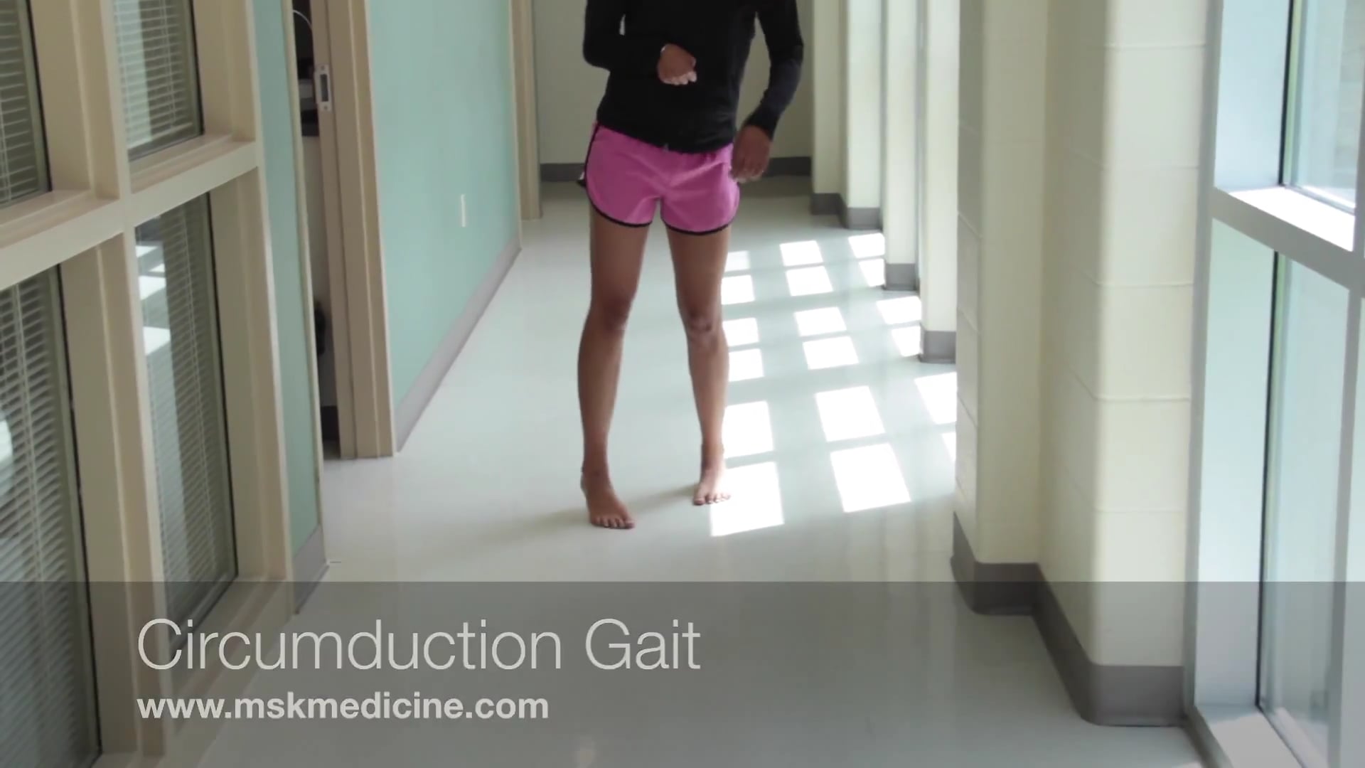Circumduction Gait [Full HD 1080p] on Vimeo