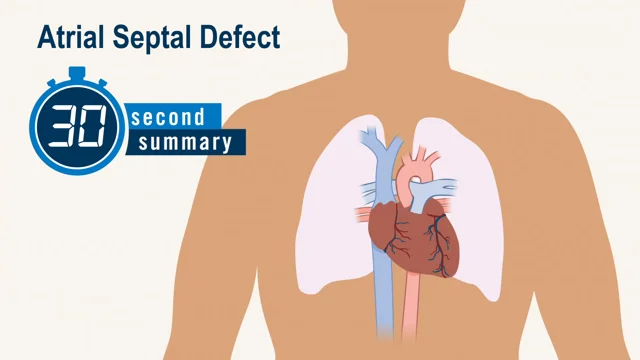 Atrial Septal Defect