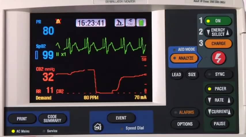 LIFEPAK 20e Defibrillator Monitor Noninvasive (Transcutaneous) Pacing ...