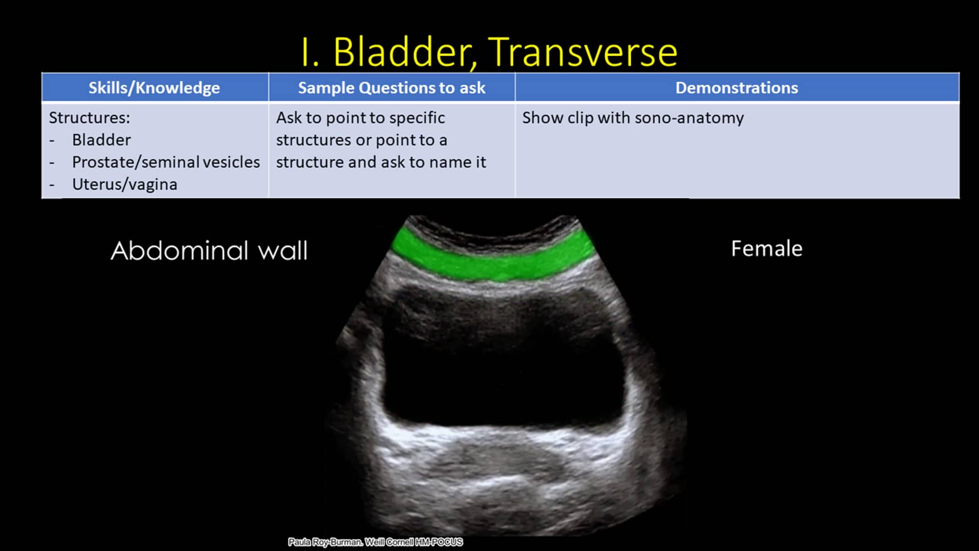4. bladder transverse. anatomy on Vimeo