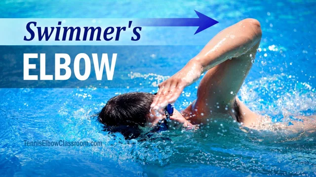 Water On The Elbow Symptoms