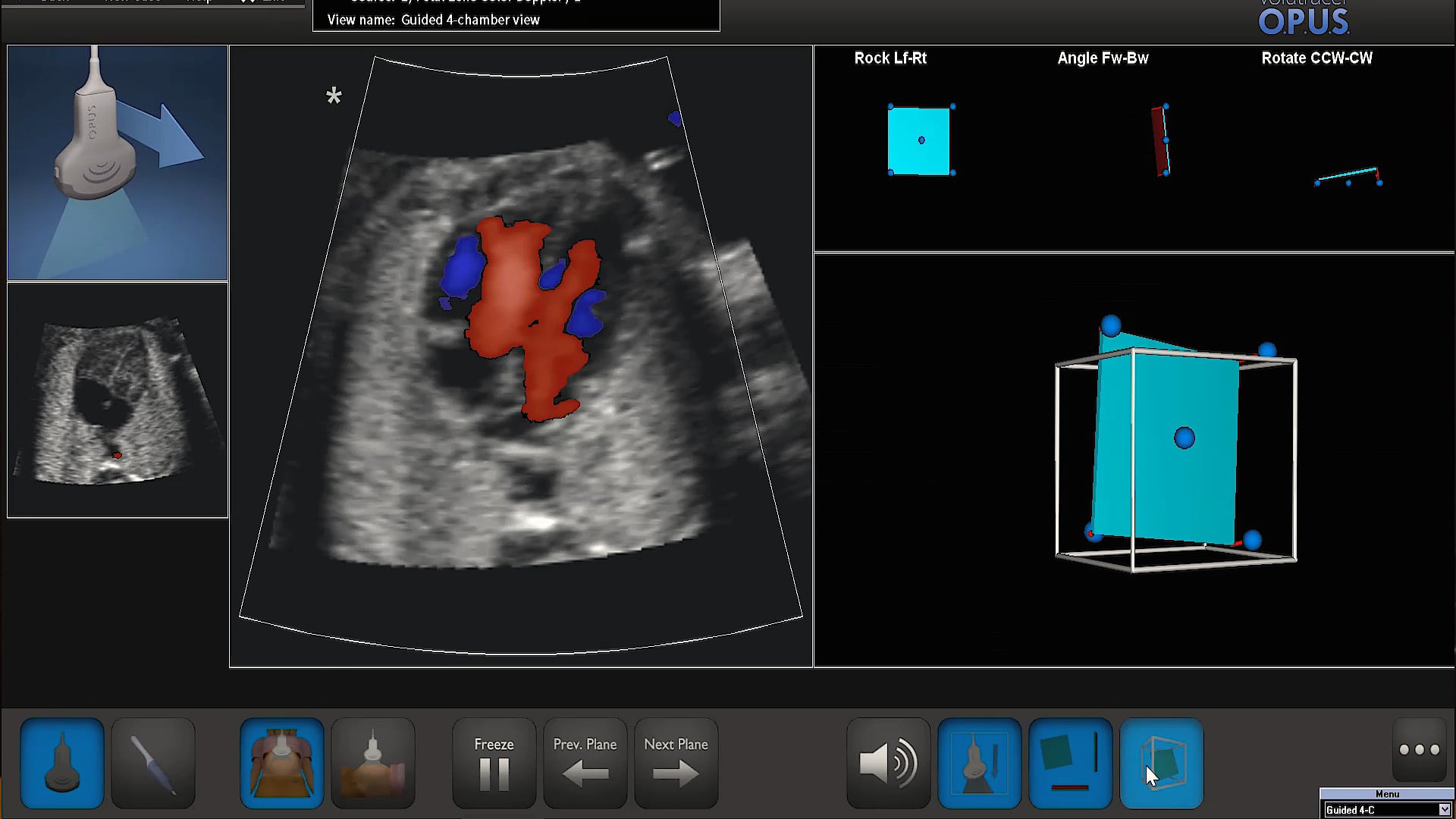 Volutracer OPUS - GPS Demostration on Vimeo
