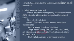 Pylorus-preserving laparoscopic gastrectomy with pyloric balloon ...