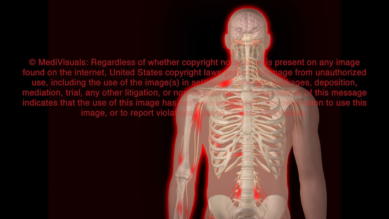 Electrocution Effects on CNS-R19834-02X on Vimeo