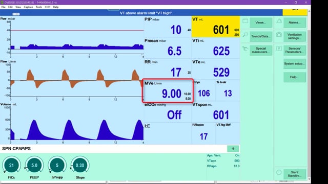 Patient-Ventilator Interactions with the ASL 5000 Breathing Simulator ...