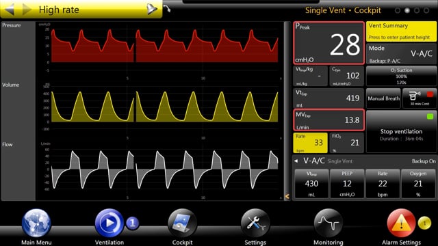 Patient-Ventilator Interactions with the ASL 5000 Breathing Simulator ...