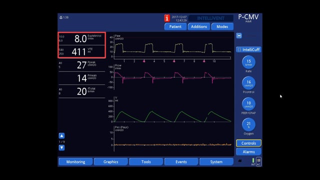 Patient-Ventilator Interactions with the ASL 5000 Breathing Simulator ...