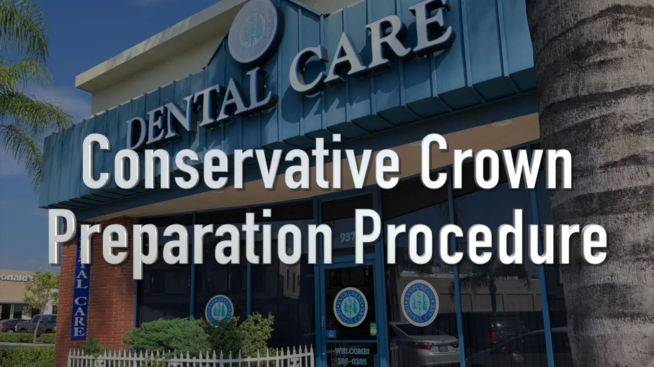 36 Conservative Crown Preperation Procedure on Vimeo
