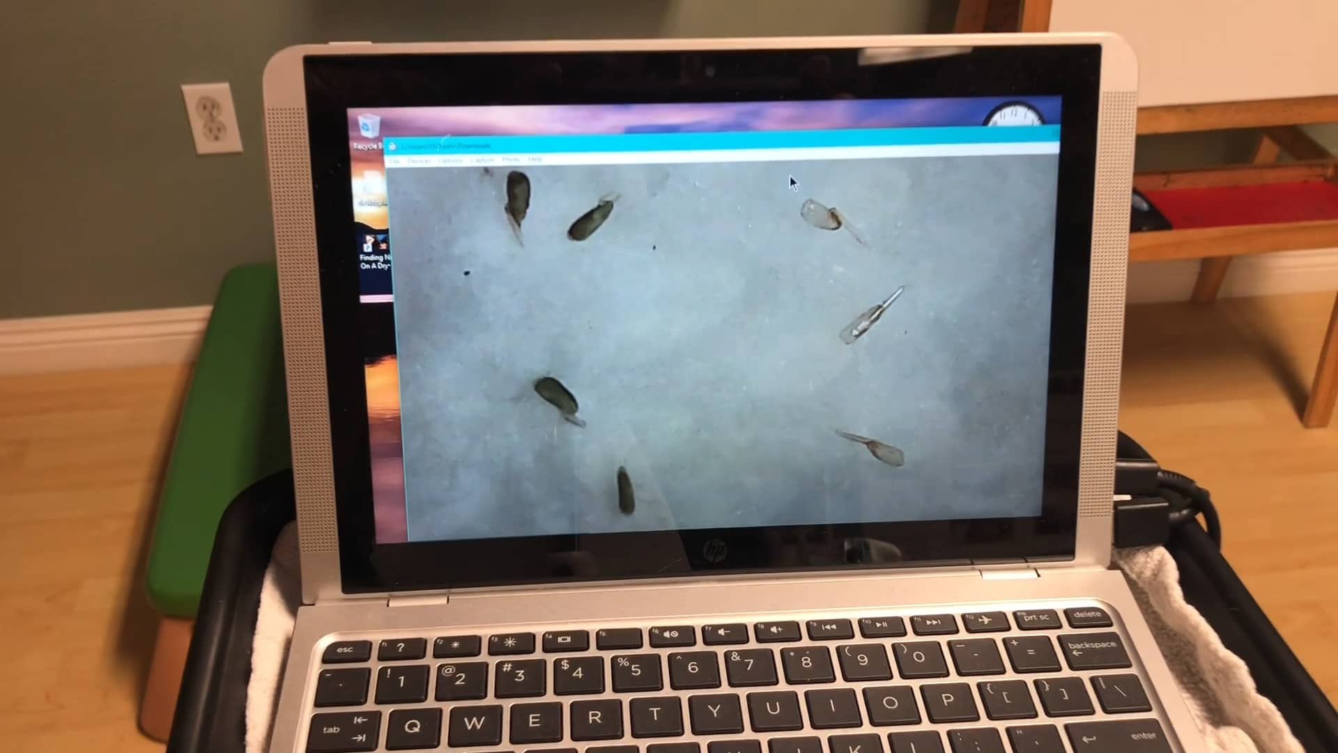 Difference between viable lice and a casing on Vimeo