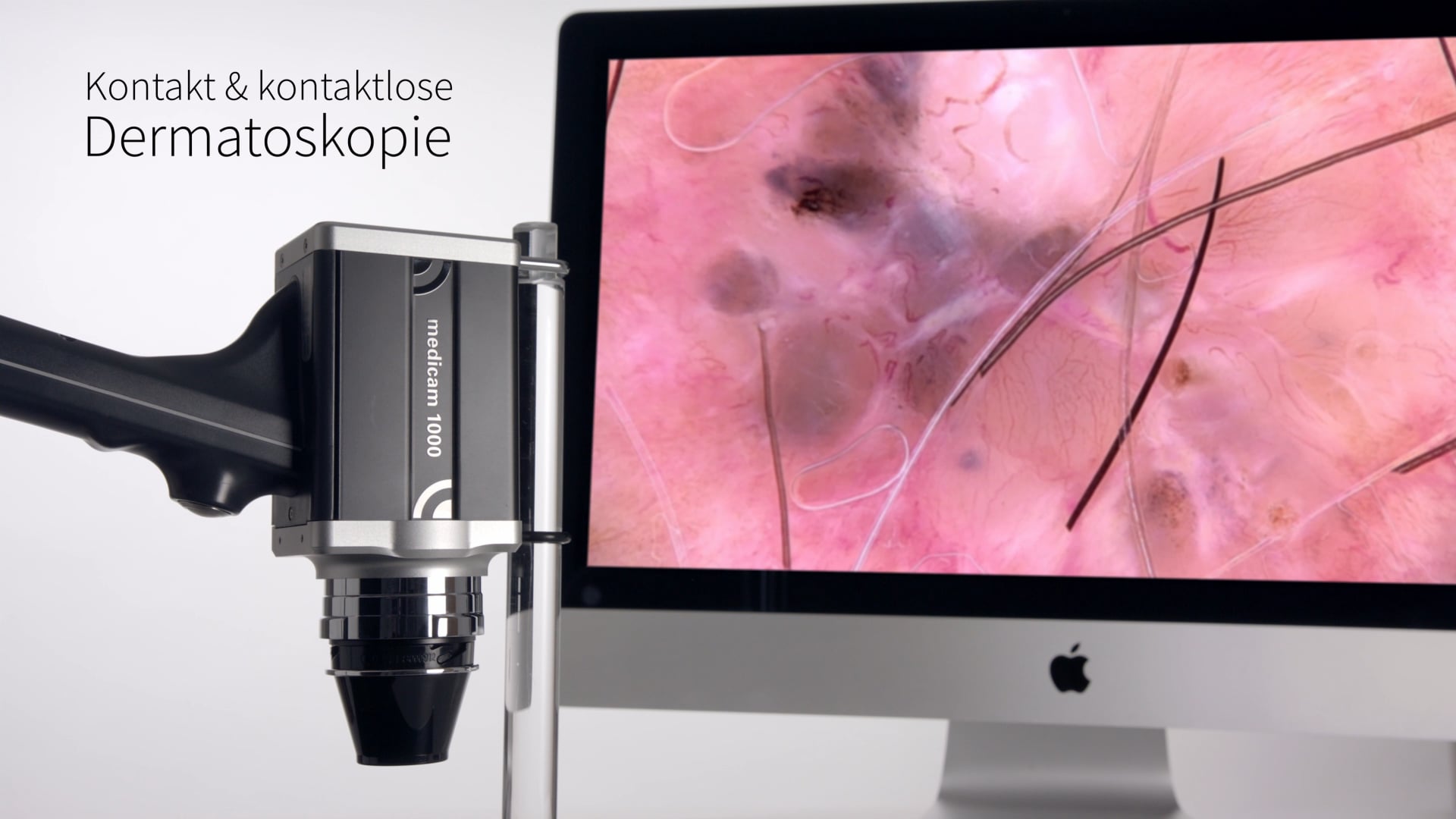 FotoFinder medicam 1000s - Der Maßstab für Videodermatoskopie weltweit ...