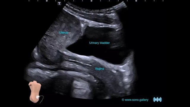 Normal Appendix - SONO.GALLERY