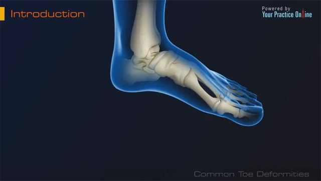 Hammer Toes Xray