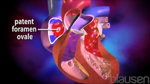Fetal Heart Circulation Animation