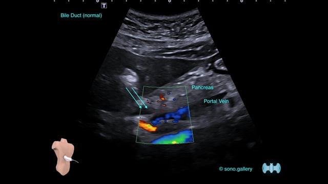 Normal Appendix - SONO.GALLERY