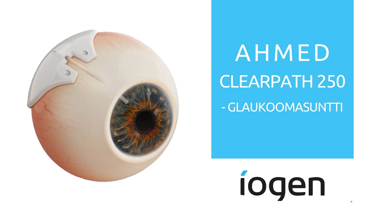 Ahmed ClearPath 250-glaukoomaimplantin kirurginen tekniikka on Vimeo