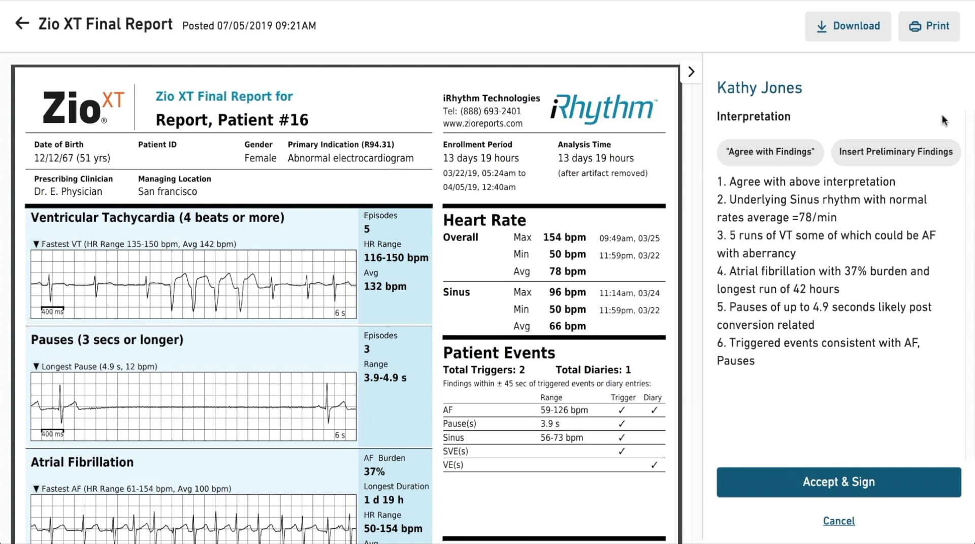 ZioSuite Online Interpretation Video
